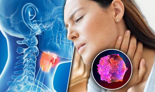 Can Sperm Cause Throat Cancer How To Prevent Throat Cancer Issuu