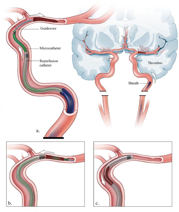 Synchro SELECT Guidewire: - Issuu