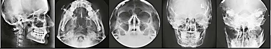 14) Skull Imaging - Issuu