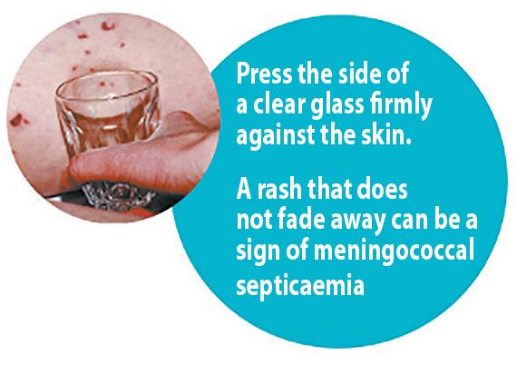 Meningitis Glass Test