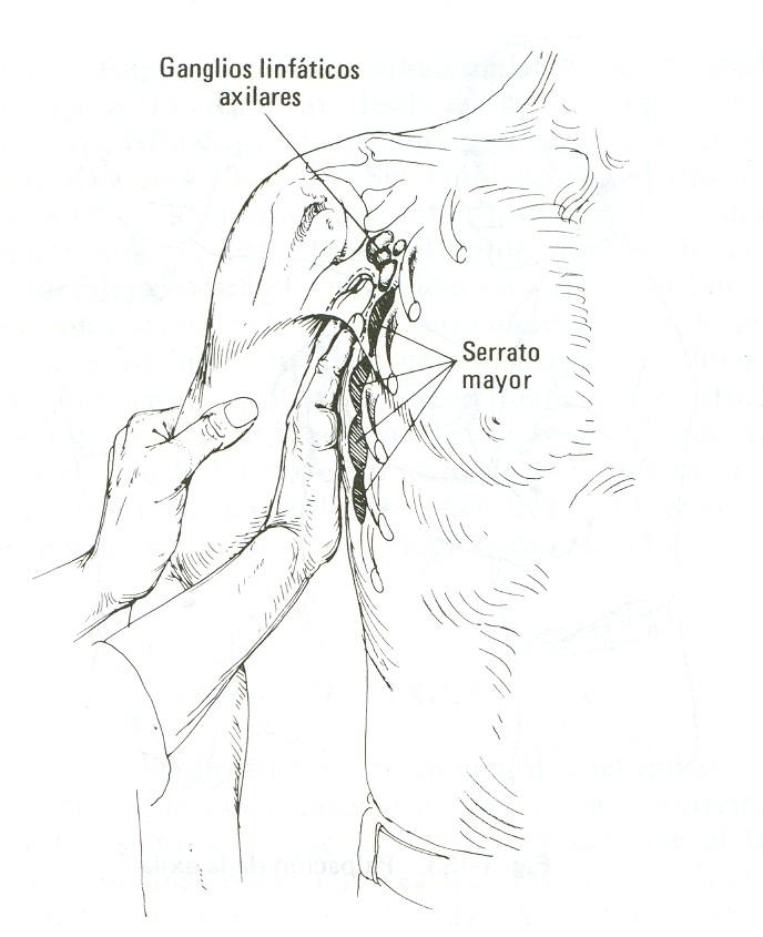 Simdrome de hombro doloroso by Ferluisgo1 - Issuu