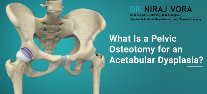What Is A Pelvic Osteotomy For An Acetabular Dysplasia Dr Niraj Vora By Nirajvoradr Issuu
