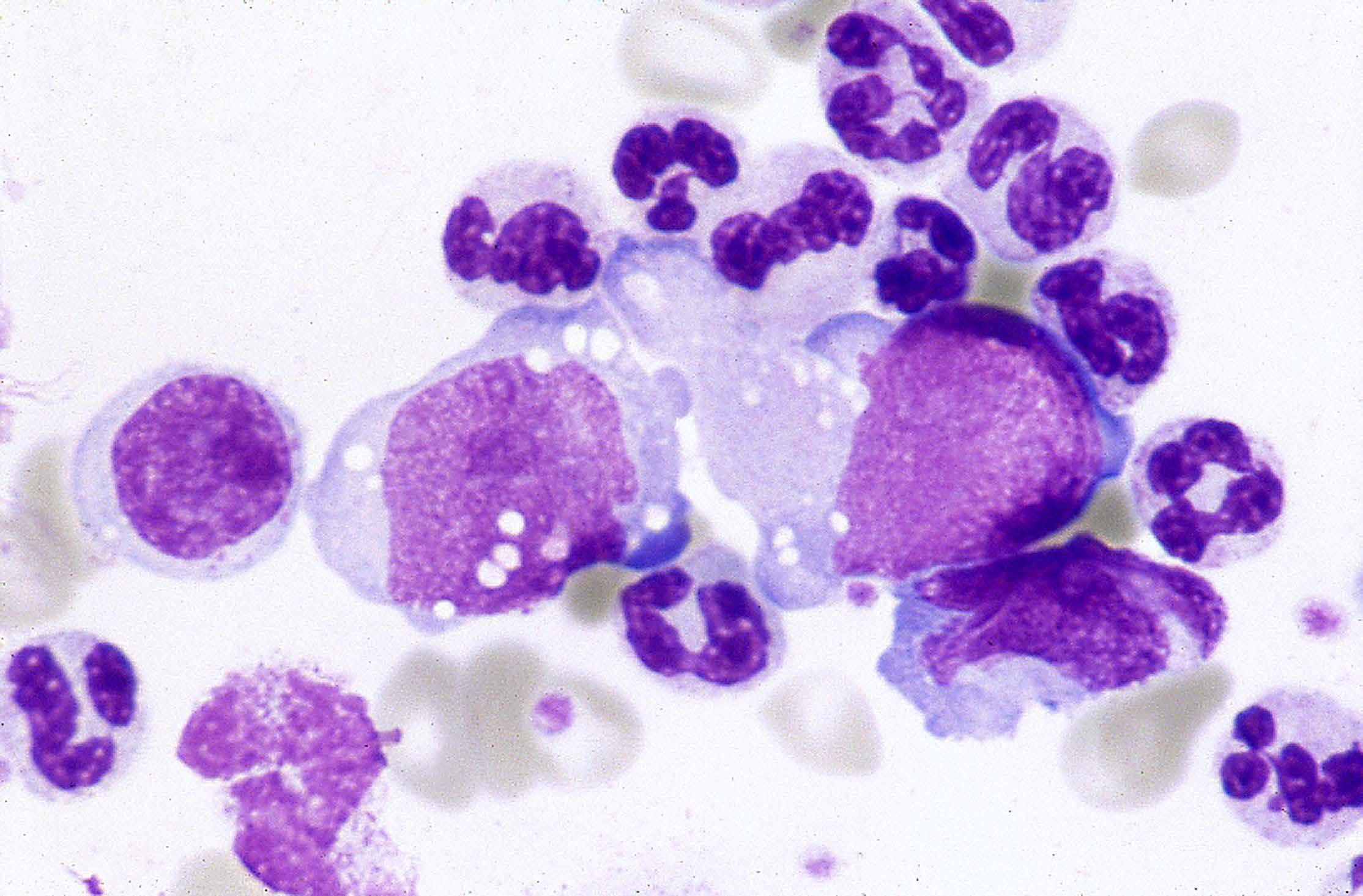 Haematologica, Volume 107, Issue 12 by Haematologica - Issuu