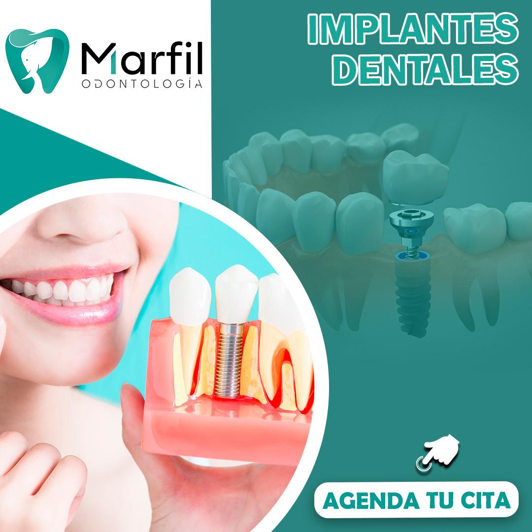 Servicios - Marfil Odontología by marfil bo - Issuu
