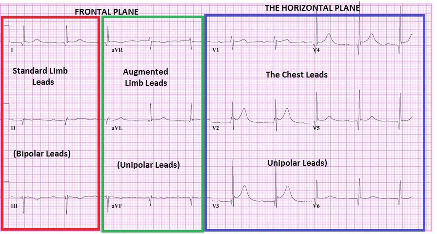 ECG Leads - Issuu