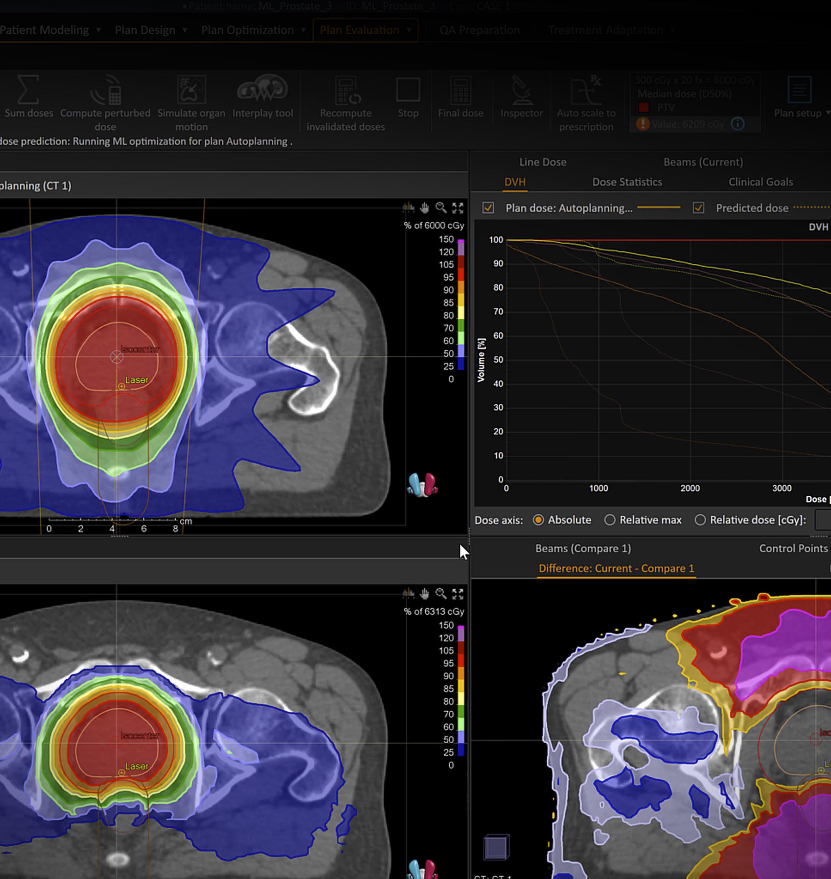 RayStation Brochure English by RaySearch Laboratories - Issuu