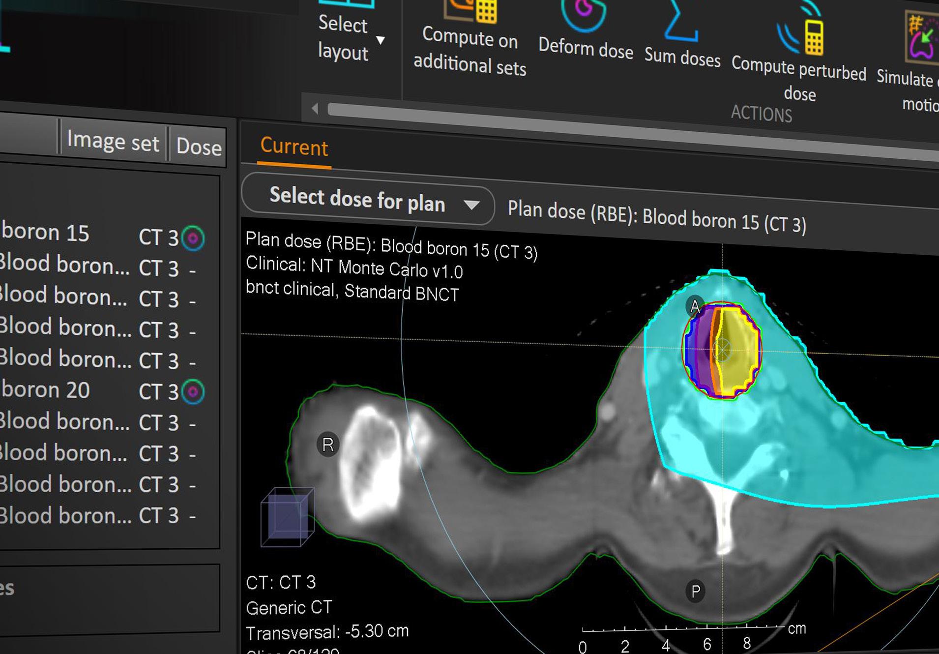 RayStation Brochure English by RaySearch Laboratories - Issuu