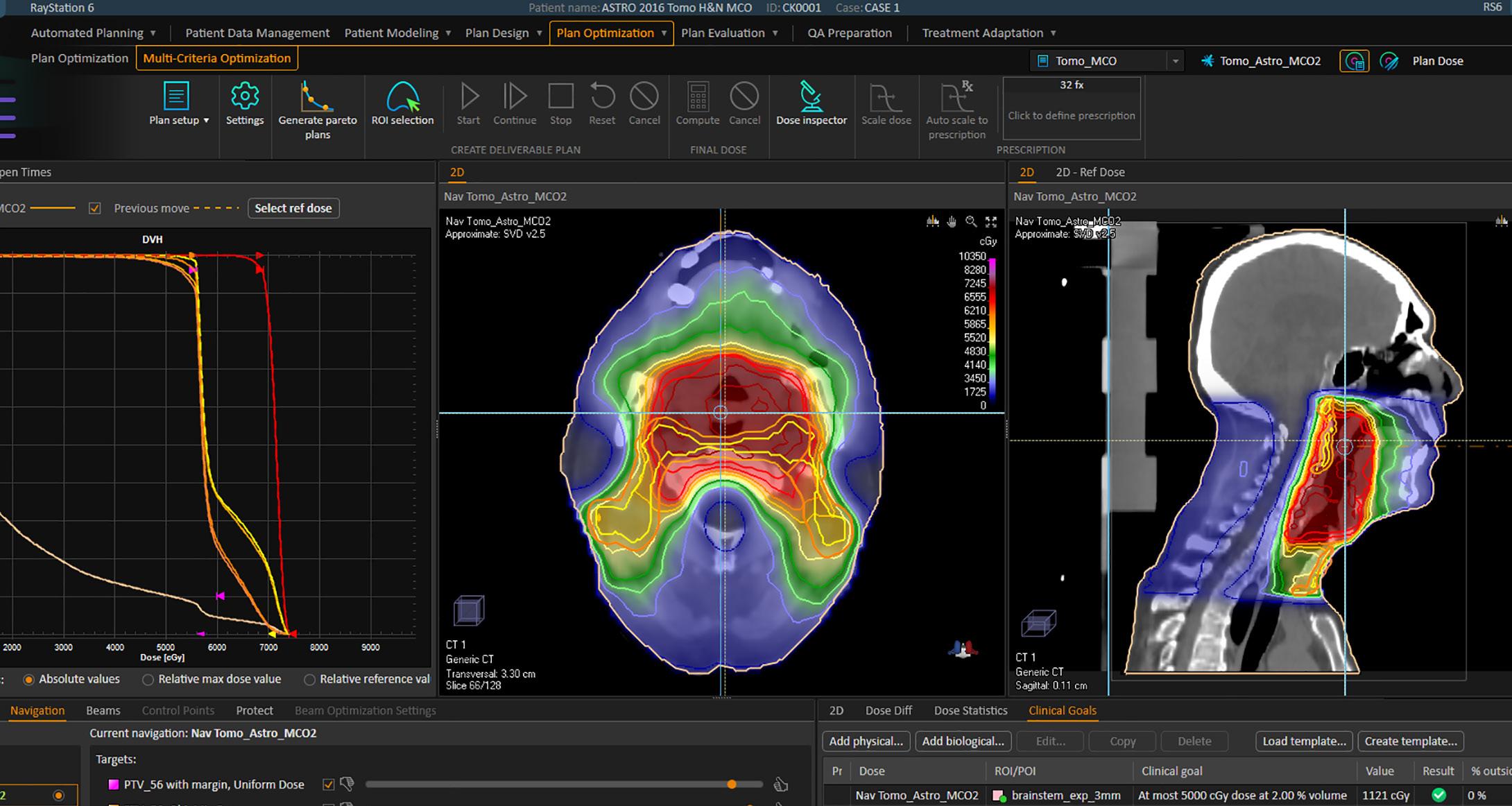 RayStation Brochure English by RaySearch Laboratories - Issuu