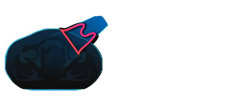 RayStation Brochure English by RaySearch Laboratories - Issuu