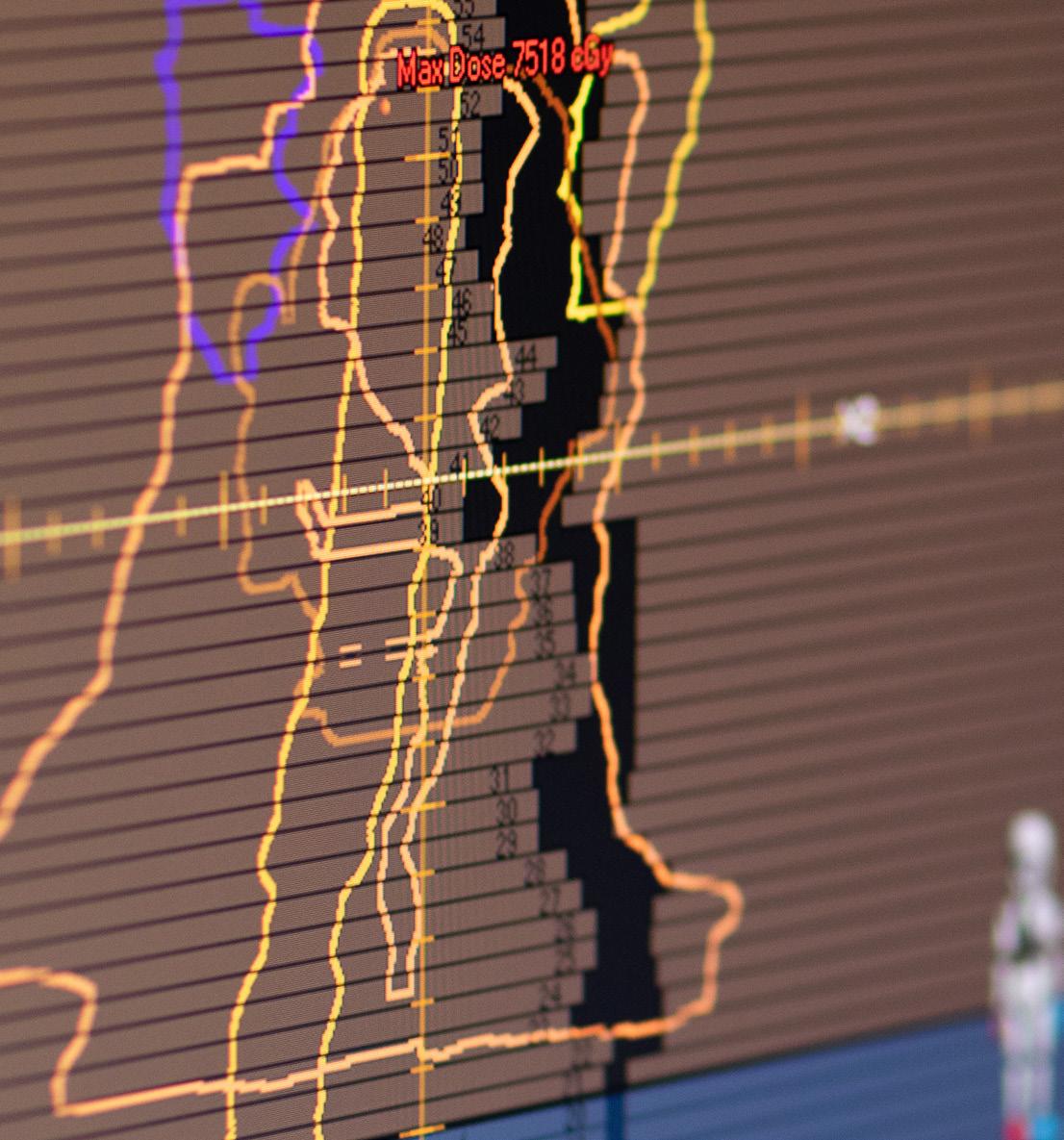 RayStation Brochure English by RaySearch Laboratories - Issuu