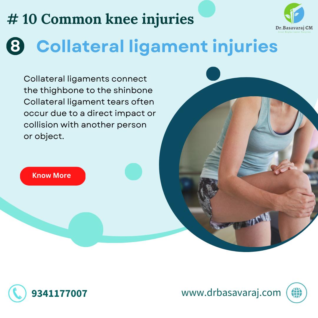 Collateral Ligament | Best Orthopedic Surgeon in RR Nagar | Dr ...
