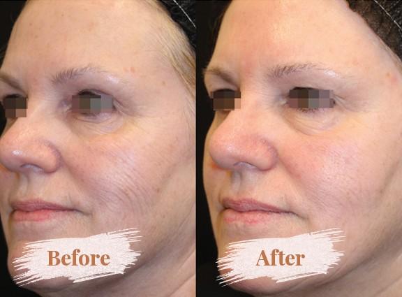 Search For The Best Skin Clinic Oakville| Skinbeautyandbeyond.com by ...