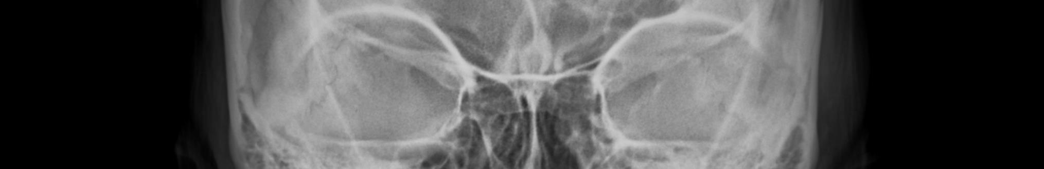 multi shot technique by Liz Lee - Issuu