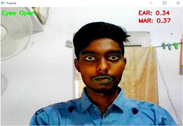 Driver Drowsiness Detection Using Face Recognition By Ijraset Issuu
