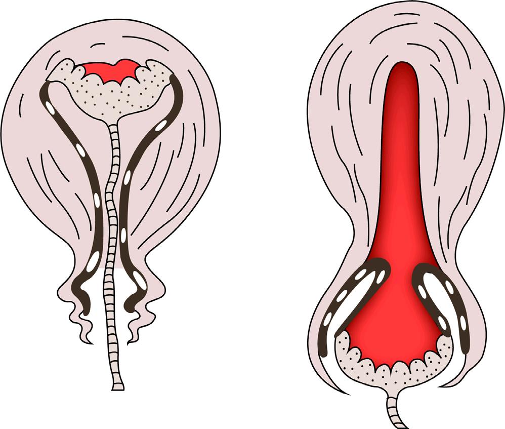 Alumbramiento - Issuu
