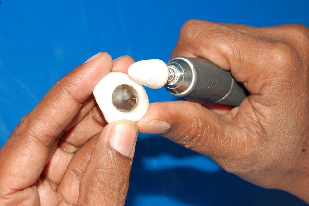 Best Artificial Eye Treatment In India By Prostheticeyecenter Issuu best-artificial-eye-treatment-in-india-by-prostheticeyecenter-issuu