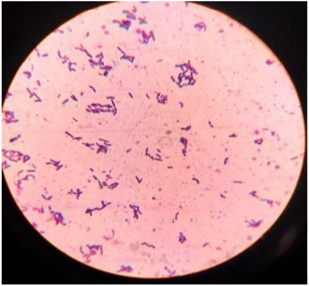 Isolation And Characterization Of Lactobacillus From Curd And Its Isolation And Characterization Of Lactobacillus From Curd And Its