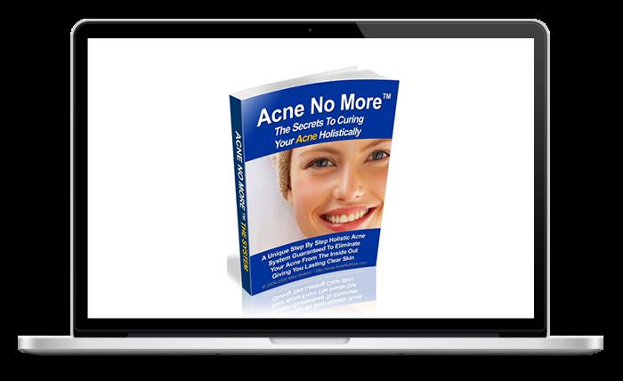 Acne No More Review by Jocasta Susan - Issuu