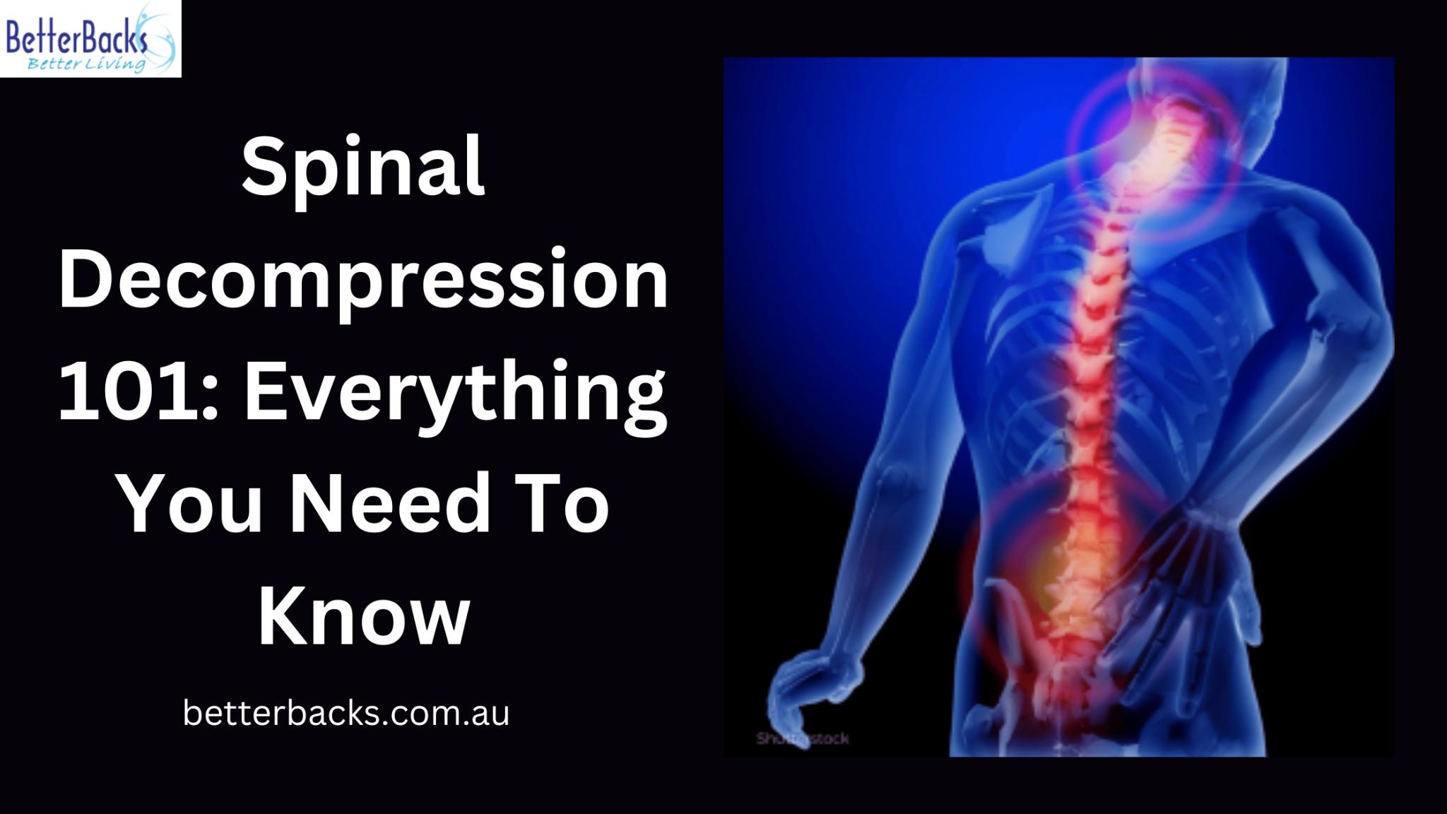 Spinal Decompression 101: Everything You Need To Know by ...