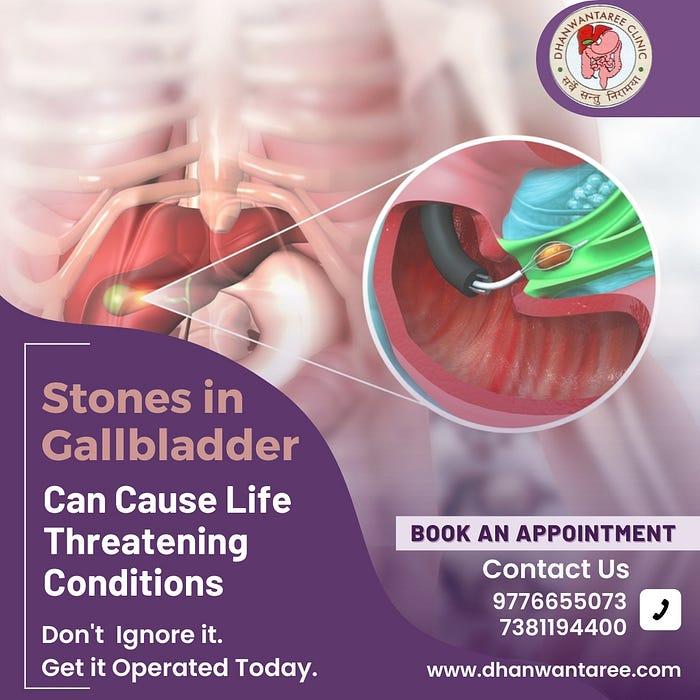 Gallbladder Stone Symptoms And Treatment Dhanwantaree Clinic Best Surgeon In Bhubaneswar By