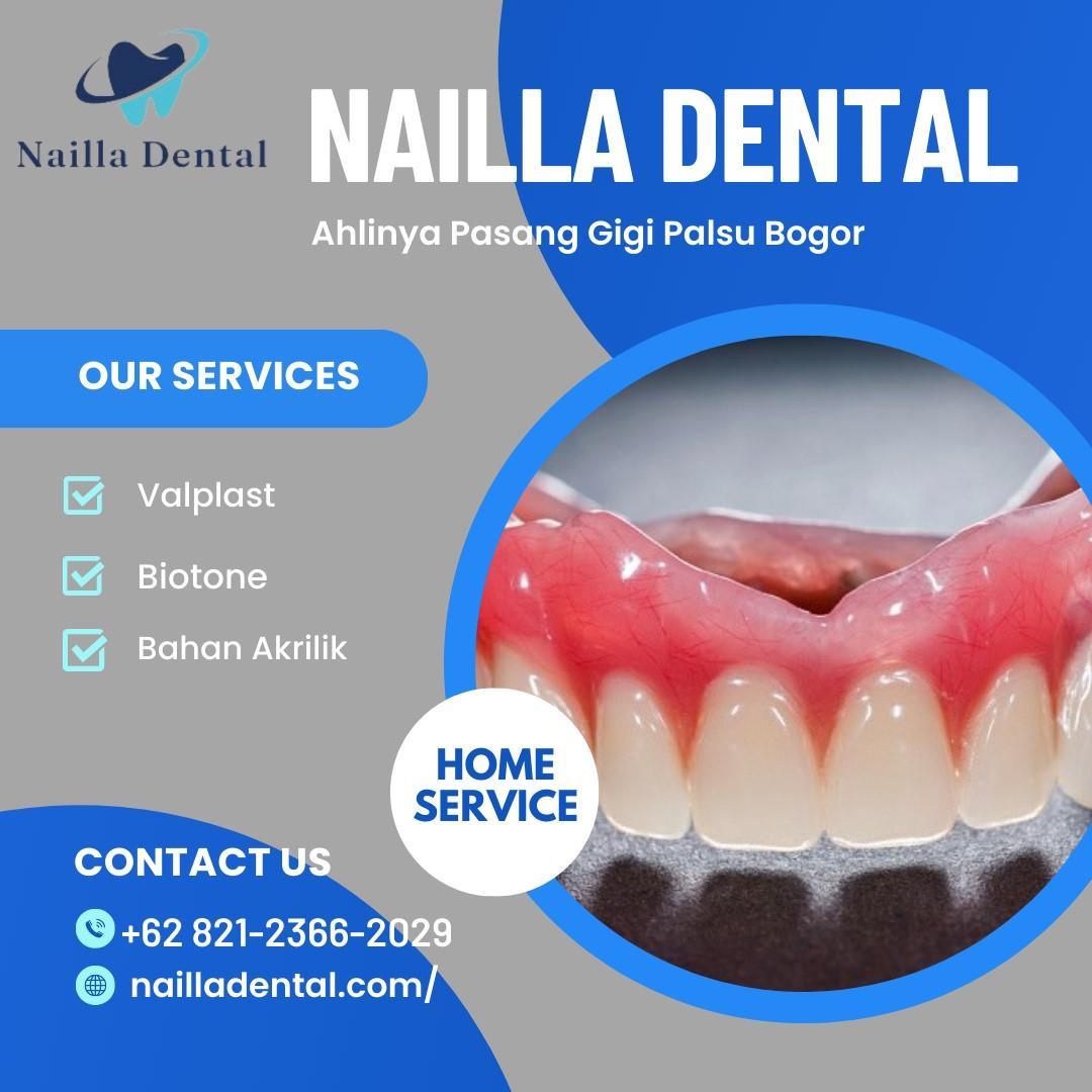 +62 821-2366-2029 Nailla Dental, Pasang Gigi Palsu Ciomas Rahayu by Nadia safitri - Issuu