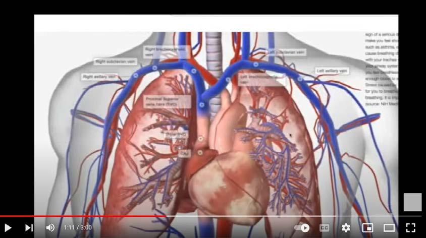 June 2023 IQ by Association for Vascular Access - Issuu