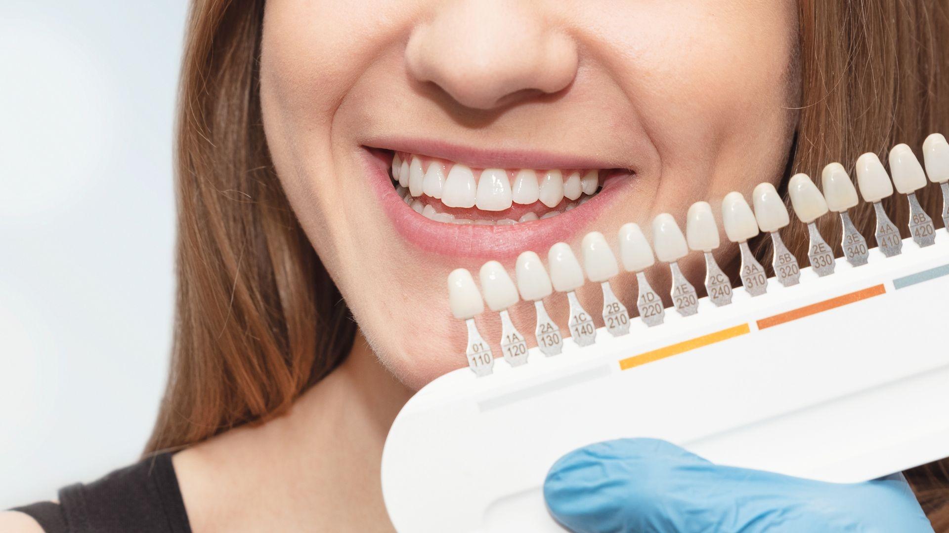 Explore A Range Of Cosmetic Dental Procedures Designed To Enhance Your ...