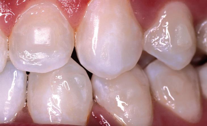 Reliance Orthodontic Products - Product Catalog by relianceortho - Issuu