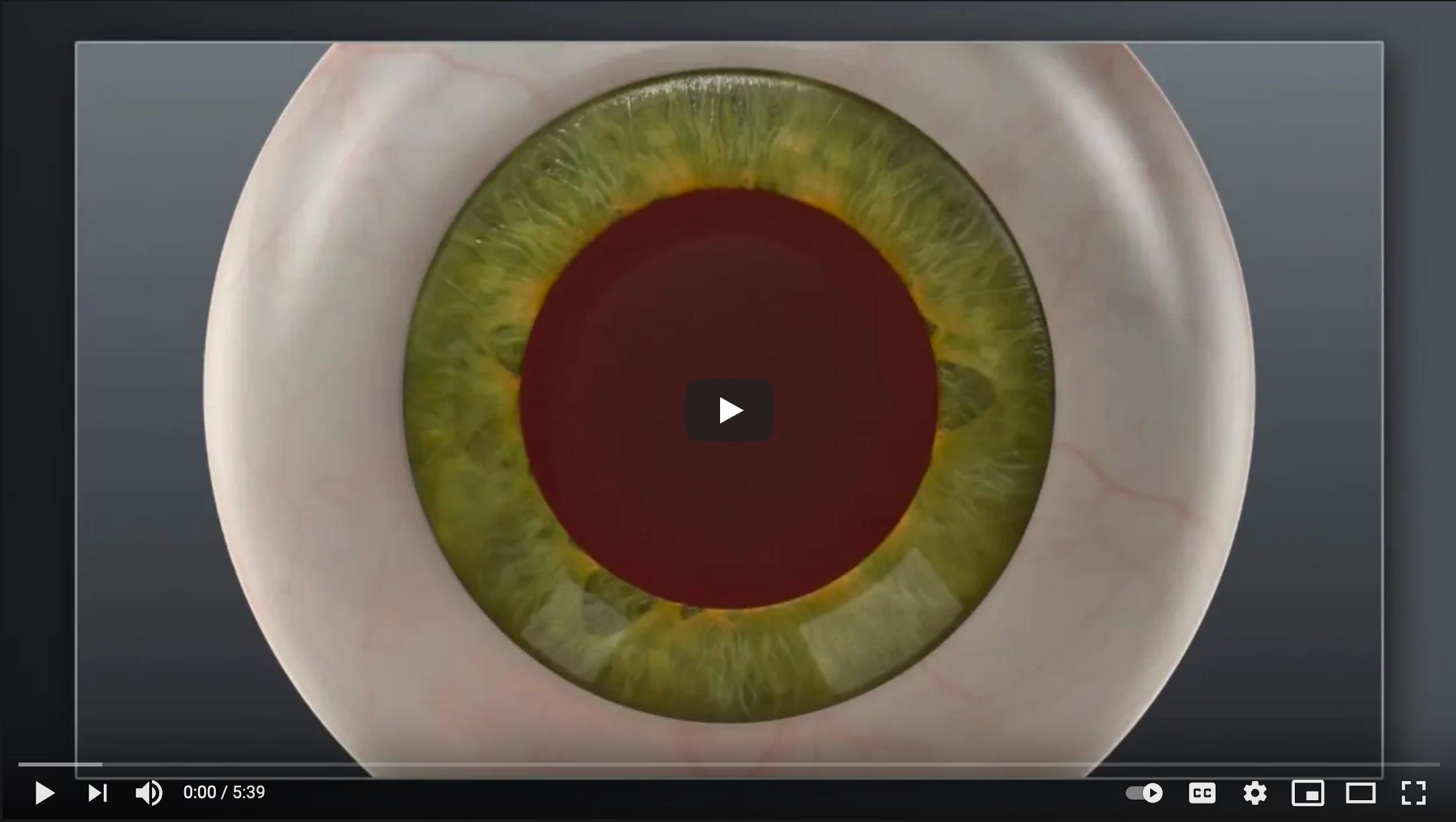 Cataract Evaluation and Treatment Booklet by Marietta Eye Clinic - Issuu