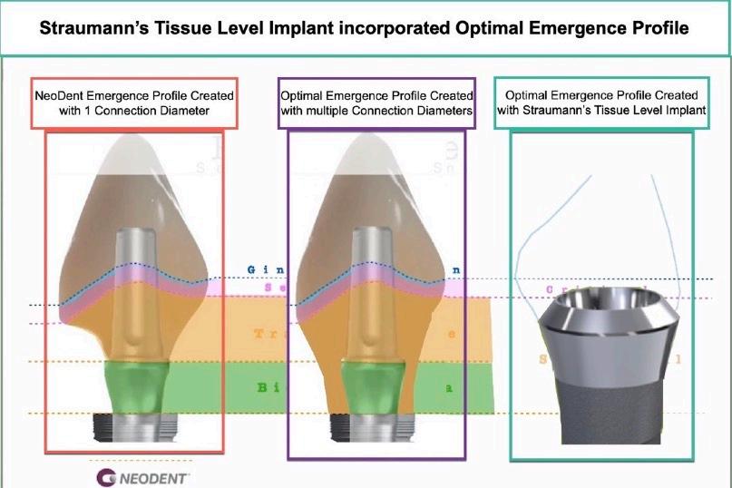 Analysis of Shortcomings of Neodents GM Implants by Dr.Niznick - Issuu