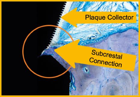 Shortcomings of the BioHorizon Implants by Dr.Niznick - Issuu