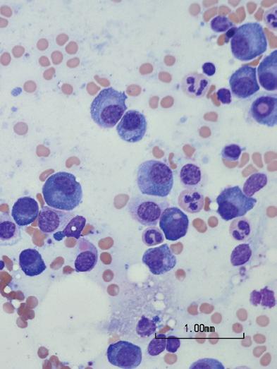 Understanding CELMoDs (Cereblon E3 Ligase Modulatory Drugs) by ...