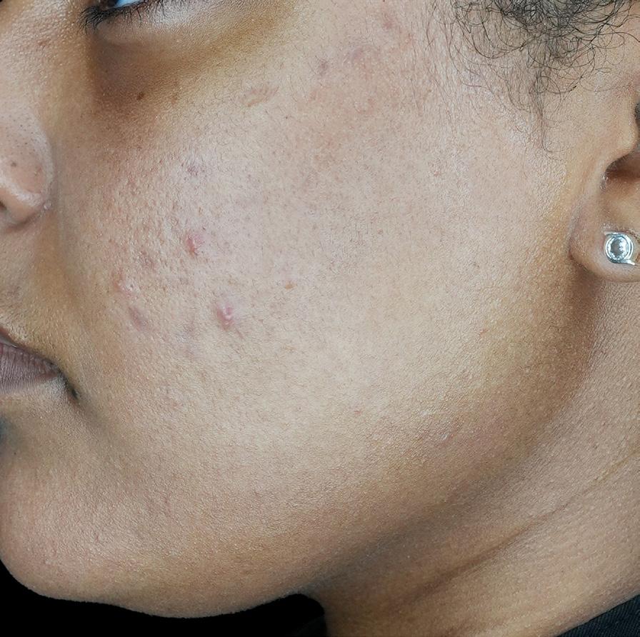 LaserAway Services Lookbook by LaserAway - Issuu