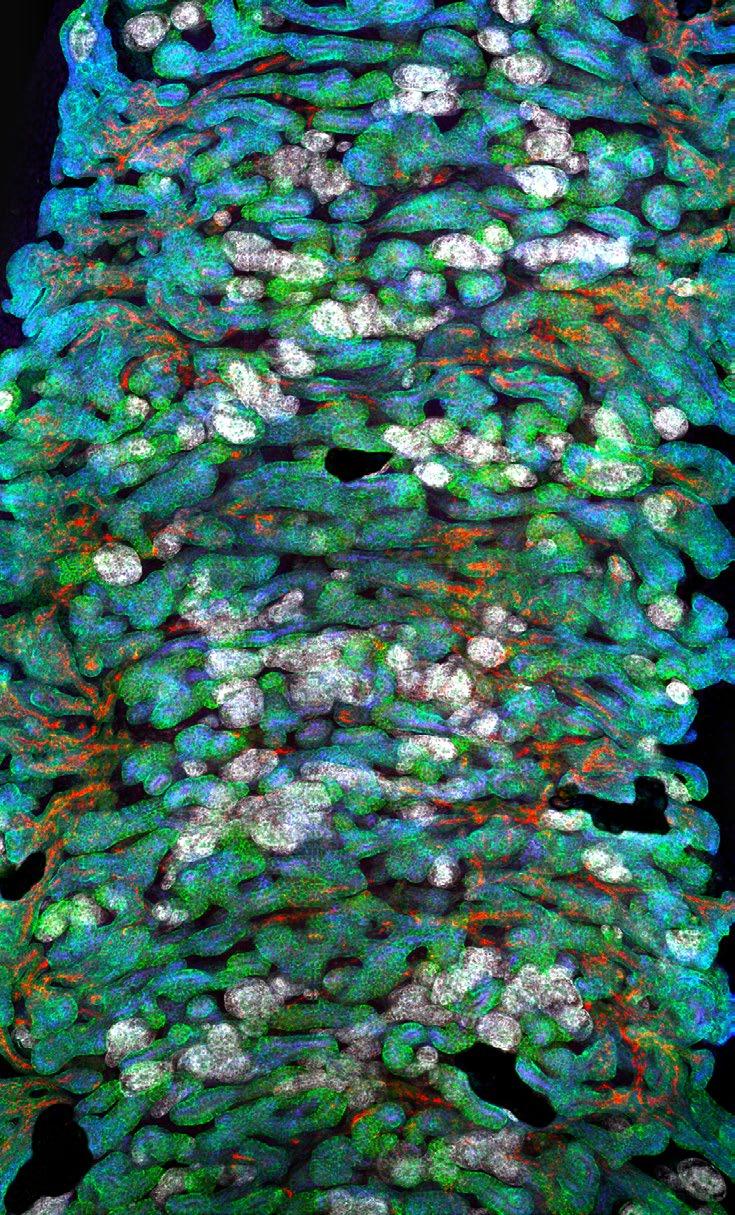 MCRI Prospectus 2024 by Murdoch Children's Research Institute - Issuu