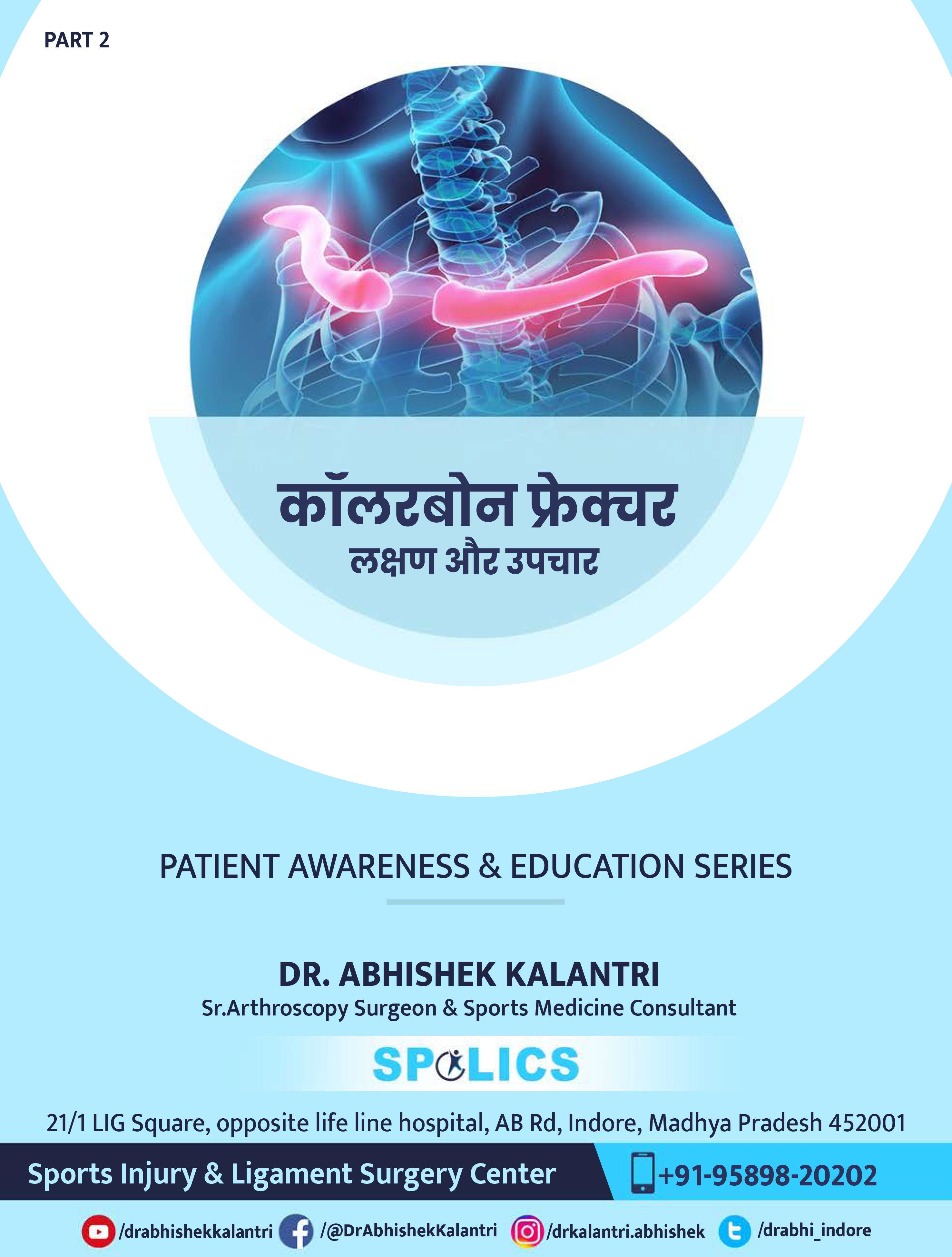 Treatment of collar bone Fracture by Dr Abhishek kalantri - Issuu