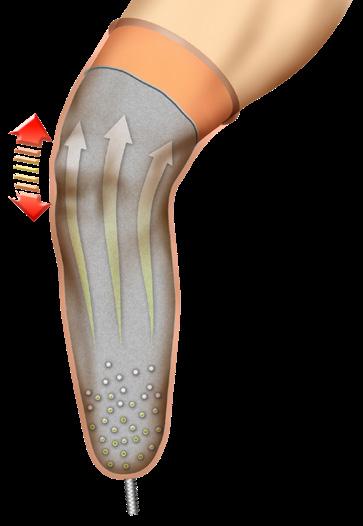 Knit-Rite Catalog 2023 by Knit-Rite/Therafirm | Thuasne USA - Issuu