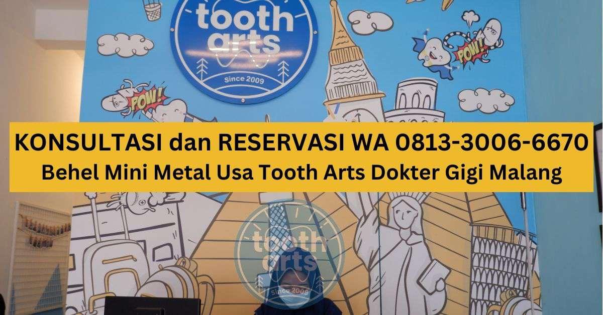 Reservasi Online WA 0813-3006-6670, Behel Mini Metal Usa Tooth Arts ...