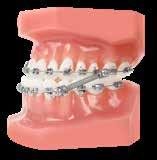 2025 DynaFlex Orthodontic Product Catalog by DynaFlex - Issuu