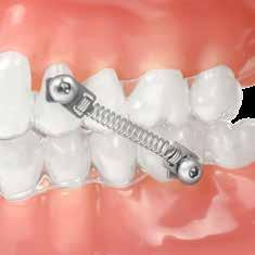 2025 DynaFlex Orthodontic Product Catalog by DynaFlex - Issuu
