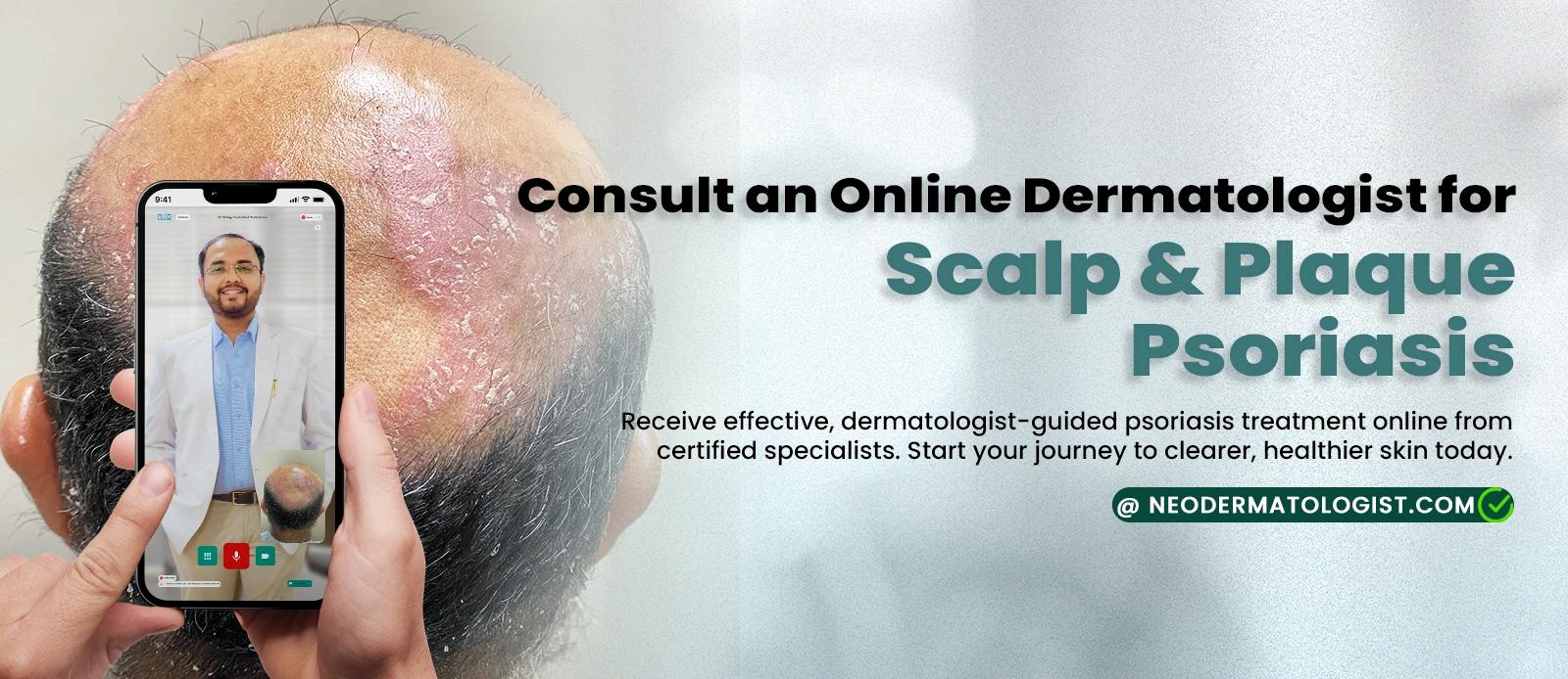 Psoriasis Treatment for Scalp & Plaque Psoriasis_ Complete Guide by ...